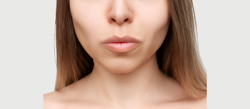 Gaunt Cheeks & How To Get Rid of Gaunt Face?